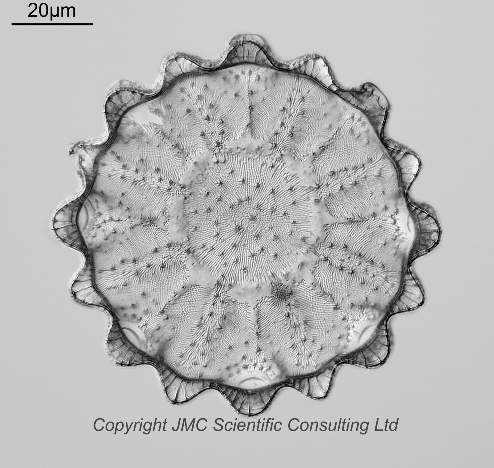 Grovea pedalis, Harry Lovett - Diatom Imaging