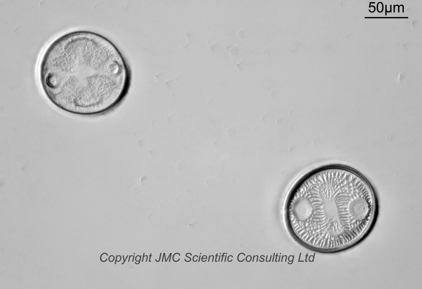 Auliscus mirabilis, Harry Lovett - Diatom Imaging